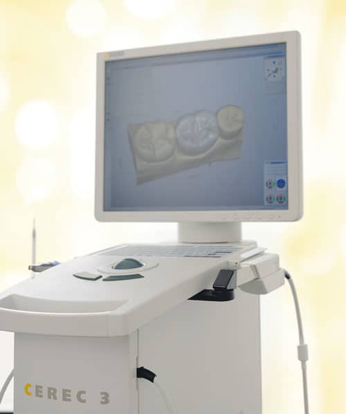 Cerec - Francis Dental